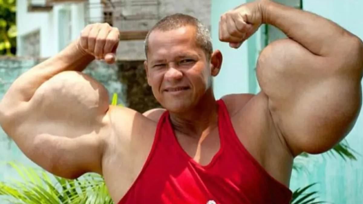 'Brazilian Popeye' bodybuilder famed for injecting alcohol and oil into ...